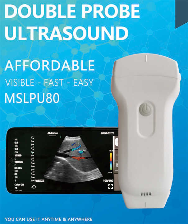 Highest Cost-Effective Double Probes Wireless Color Doppler Ultrasound ...
