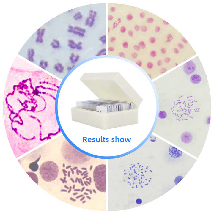 Human Chromosome Microscope Slides 14 Pieces Set Genetics Slides DNA ...