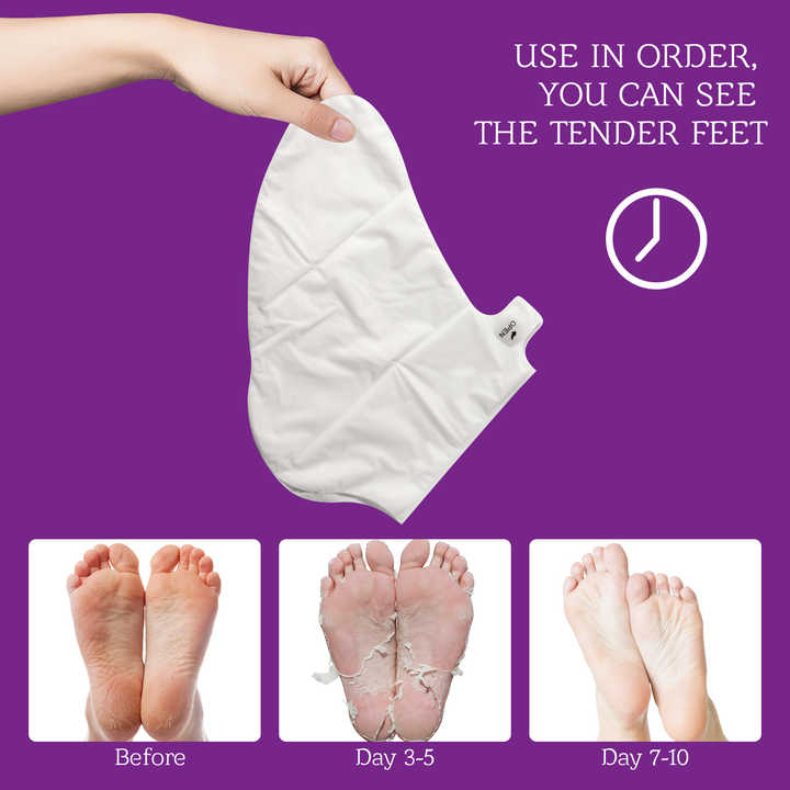 ALIVER Foot Peeling Mask - Exfoliate & Moisturize Feet