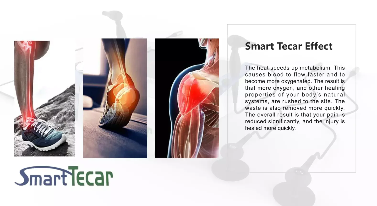 RET/CET Diathermy Capactive And Resistive Energy Transfer Tecar EMS ...