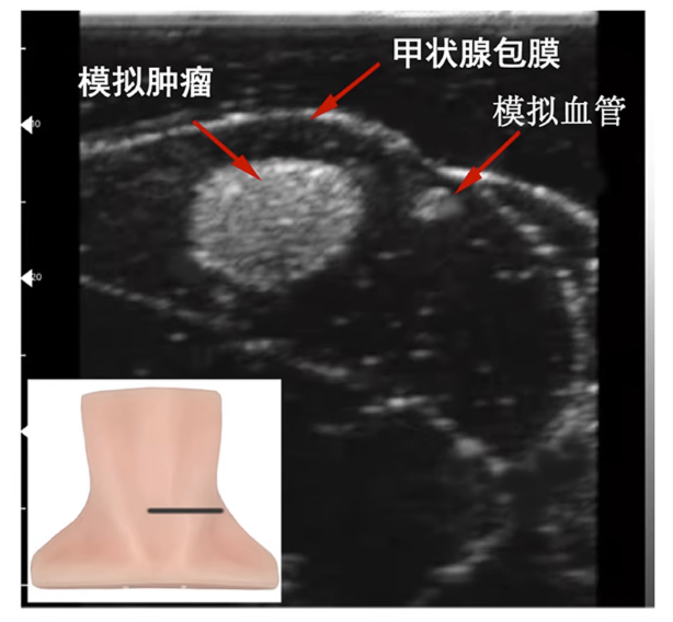 Medical Science Ultrasound Guided Thyroid Puncture Model for Teaching B ...