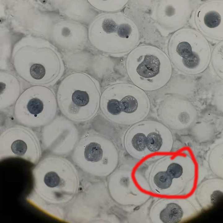 Microscope Slides - Transverse Section of Uterus Ascaris