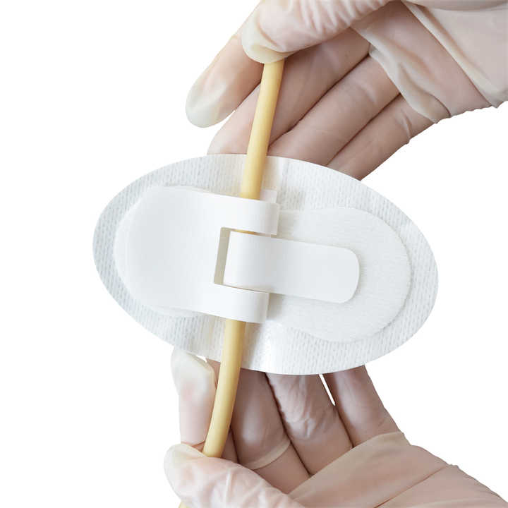 Secure Medical Consumables Catheter Fixation Device Urethral Catheter ...