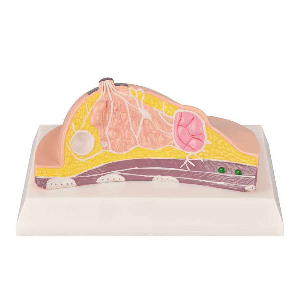 Huichun Breast Nodule Common Disease Pathology Anatomical Model for ...