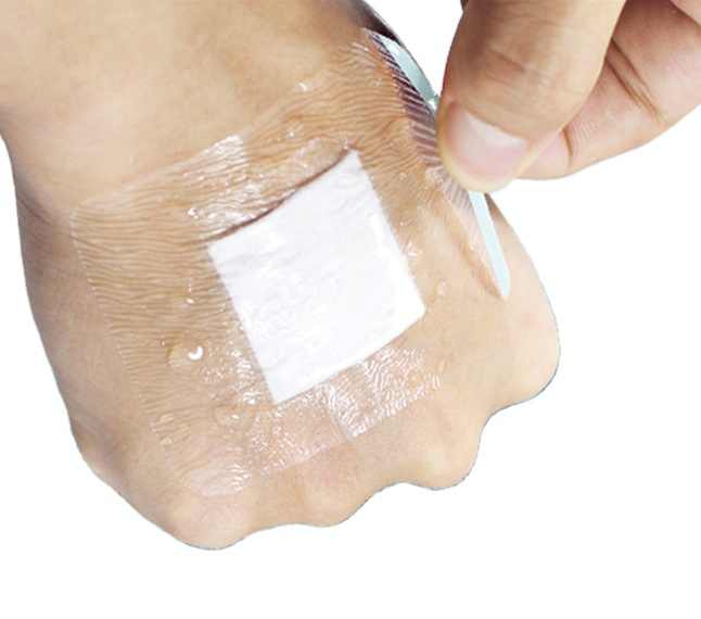 Transparent Dressing Adhesive Wound Dressing Island Dressing - Buy ...