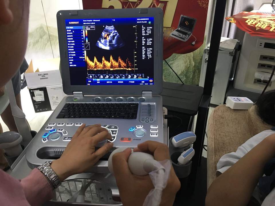 15 inch professional cardiac color doppler TDI ultrasound Hospital ...