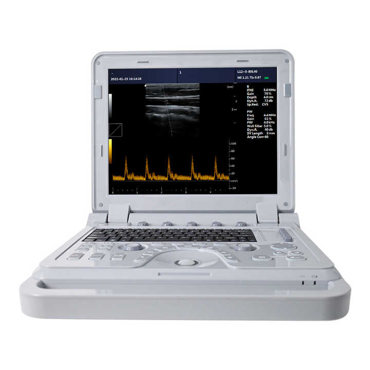 CONTEC CMS600P2 Plus Ultrasound Scanner - Portable & CE Certified