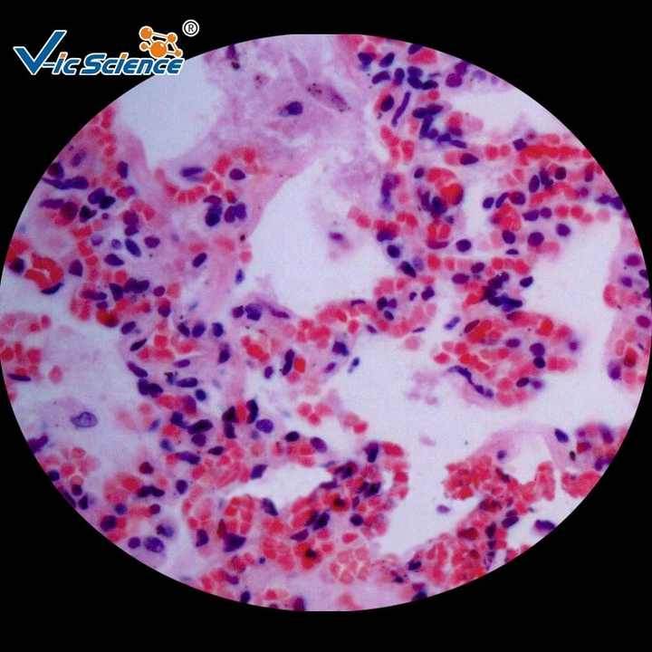 Microscope Slide of Pathology Disease Educational Slides