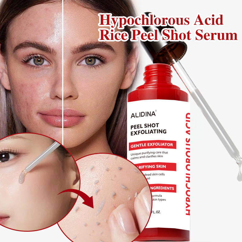 ZS ODM Hypochlorous Acid Rice Peel Shot Serum for Skincare