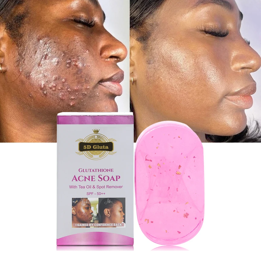 Best soap to remove dark spots on face store