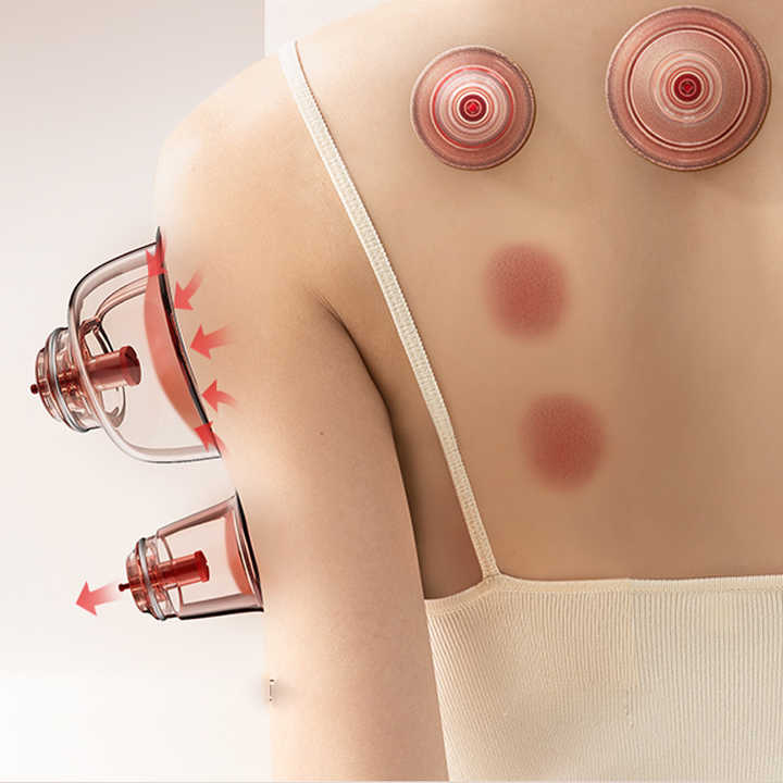 Glass Cupping Set with Silicone Vacuum Suction Cups Facial & Body ...