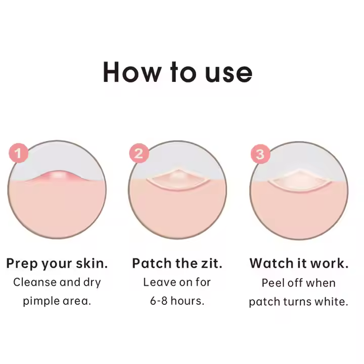 Independent Packaging Cartoon Pattern Hydrocolloid Essential Oil Acne