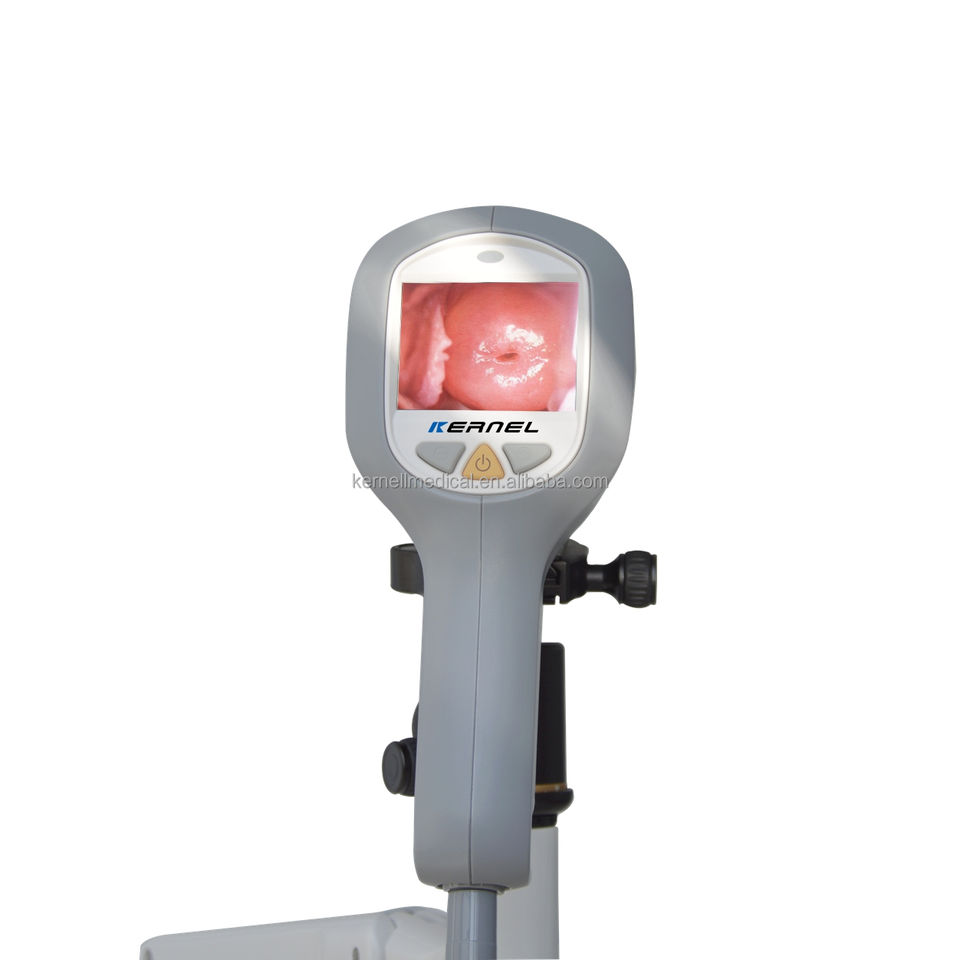 CE Medical Endoscope Colposcopia Optical Binocular Portable Colposcope ...