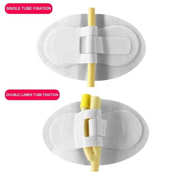 Urine Catheter Leg Stickers Catheter Leg Band Fixing Patches Catheter ...