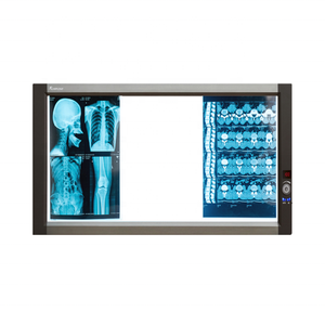 x ray film view box for Hospitals - Alibaba.com