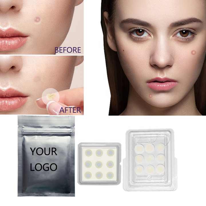 Microneedle Pimple Patches - Effective Acne Treatment
