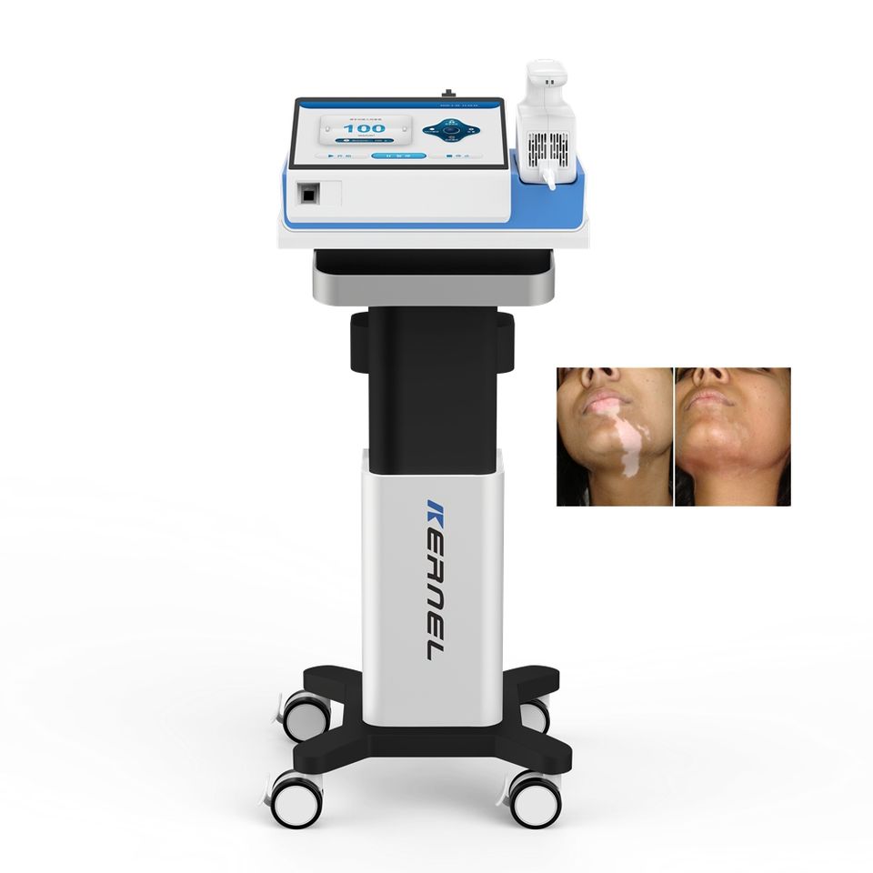 High Effective 308nm Excimer Laser Vitiligo Phototherapy Device 8 ...