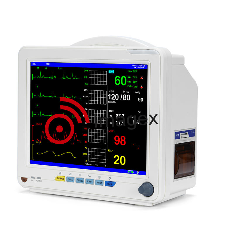 Veterinary Anesthesia and ICU Monitor with ECG SpO2 NIBP TEMP and EtCO2 ...