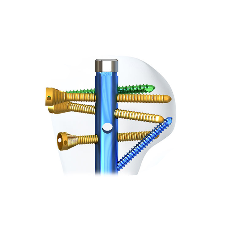 Professional Medical Orthopedic Implant Multiloc Humeral Interlocking ...