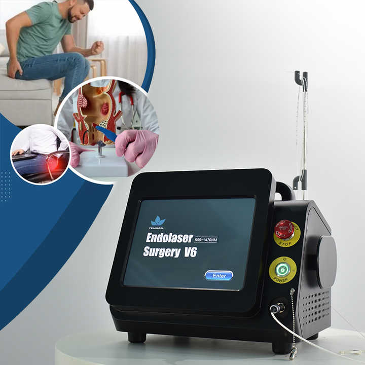 Minimally Invasive Proctology 1470nm 980nm 47W Laser Treatment Hemorrhoids Anal Fistula Surgery ...
