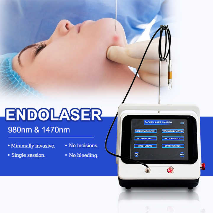 Endolaser Sculptra BBL Buttock Filler Laser 980nm Lipo 1470nm ...