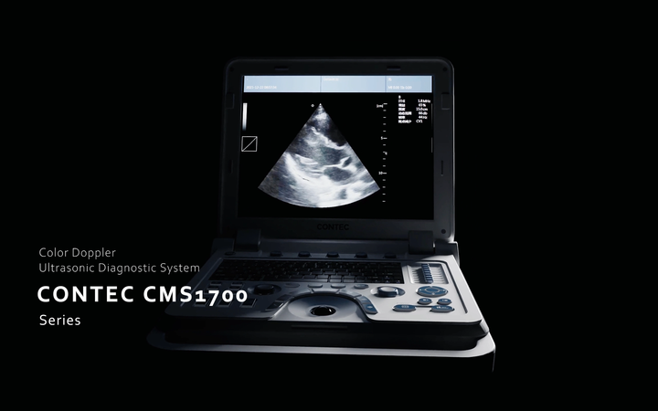 CONTEC CMS1700A Portable Ultrasound Machine - 1 Year Warranty