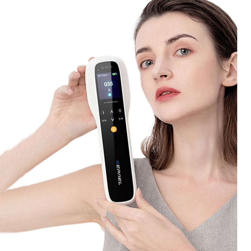 USA Certificated Kernel 308nm Excimer Laser LED UVB Phototherapy Narrow ...