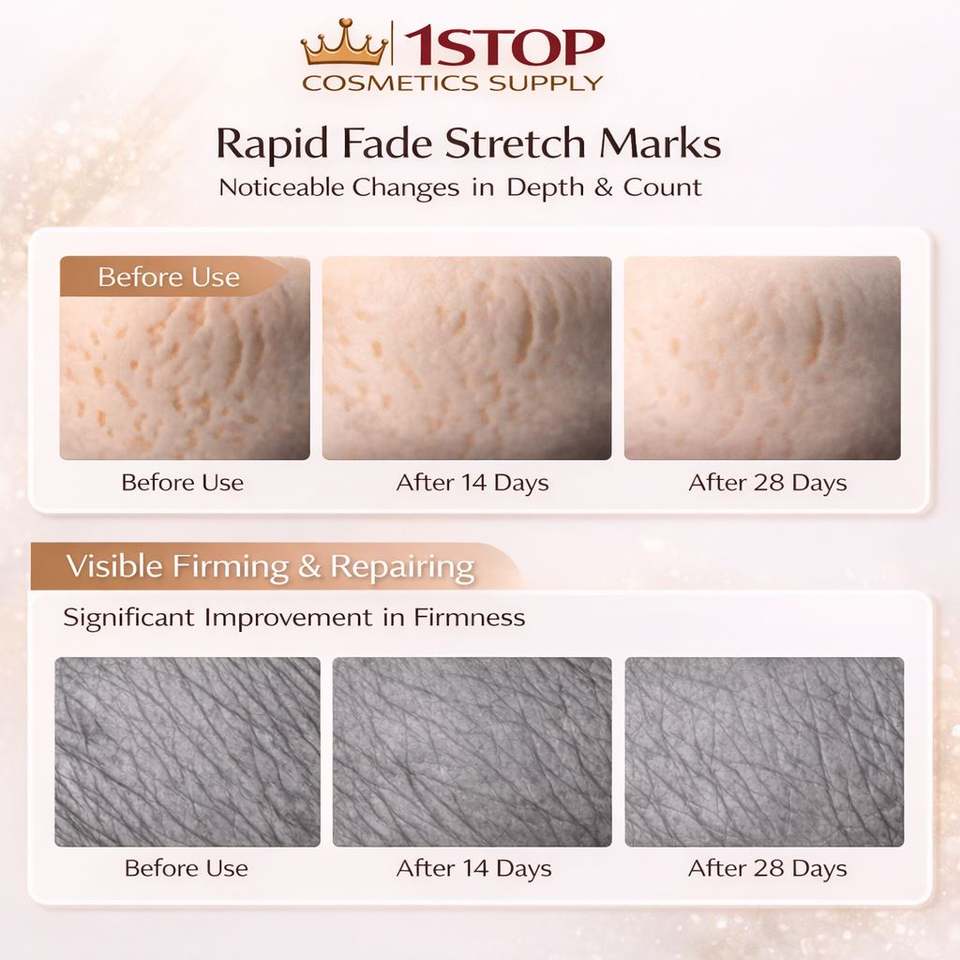 Organic Light-Weight Stretch Mark Vanishing Cream Shea Butter Herbal ...