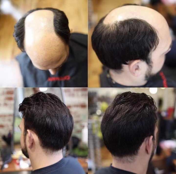 Men Hair Prosthesis Male Hair System Invisible Natural Hairline Full ...