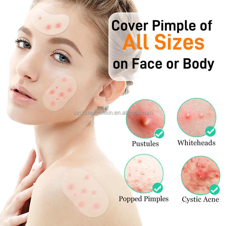 Custom Color and Shape Hydrocolloid Acne Patch Private Label Round ...