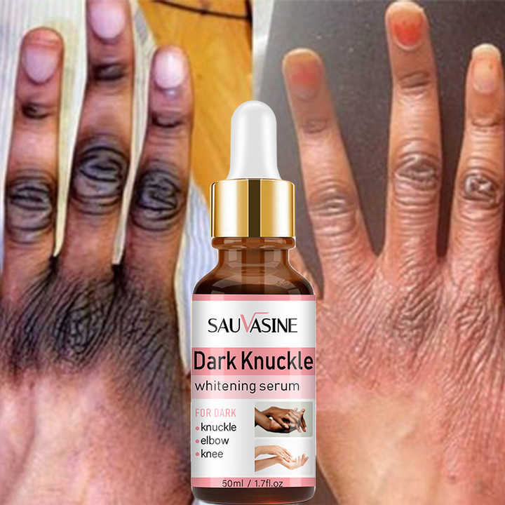 7 Day Dark Knuckles Whitening Serum - Smooth & Elastic Skin