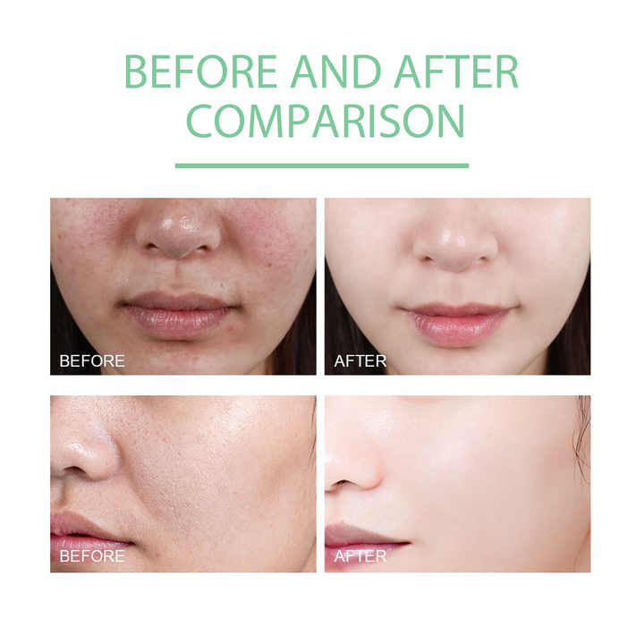 Wholesale Herbal Purifying Exfoliating Gel Cleaning Pores Removing Dead ...
