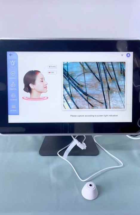 OEM Scalp Analysis System AI Intelligent for Scalp Analysis/Hair Care ...