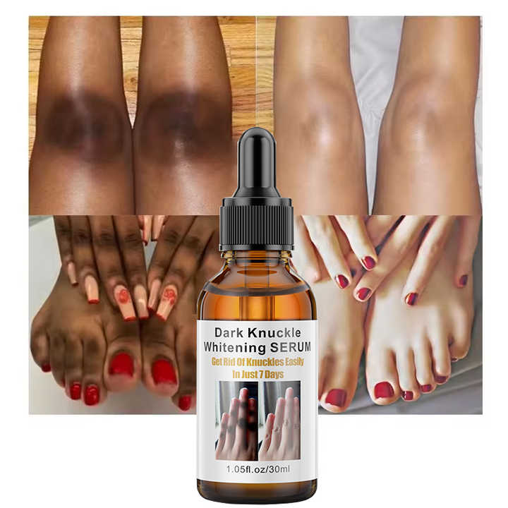 Dark Knuckles Fast Whitening Serum - Intense Stains Remover