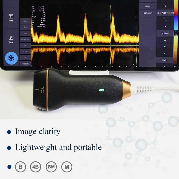 Abdominal Echocardiography Handheld Ultrasound Probe Portable Wireless ...