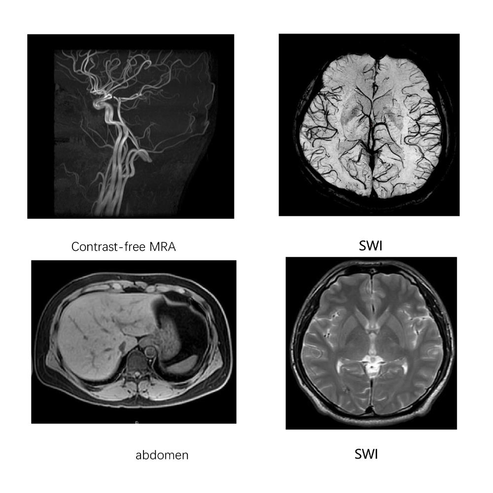 How to Choose the Best MRI Machine for Medical Use: A Complete Guide