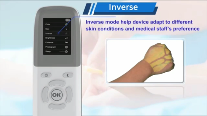 China Vein Viewer Price Handheld Portable Vein Viewer For Different Use ...