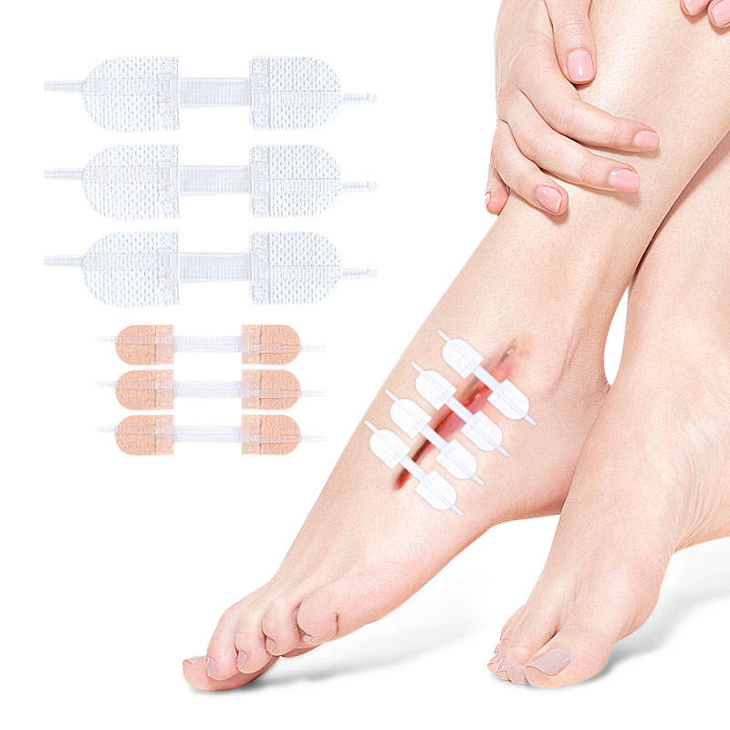 Wound Closure Strips - Secure Wound Closure System