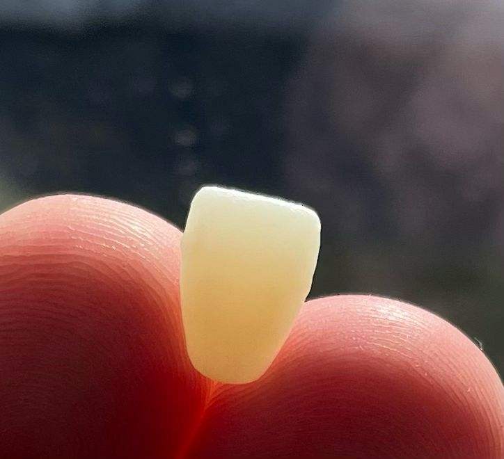 Kingch Electric Dental Zirconia Block for Coping/Anterior/Crown 98*12 ...