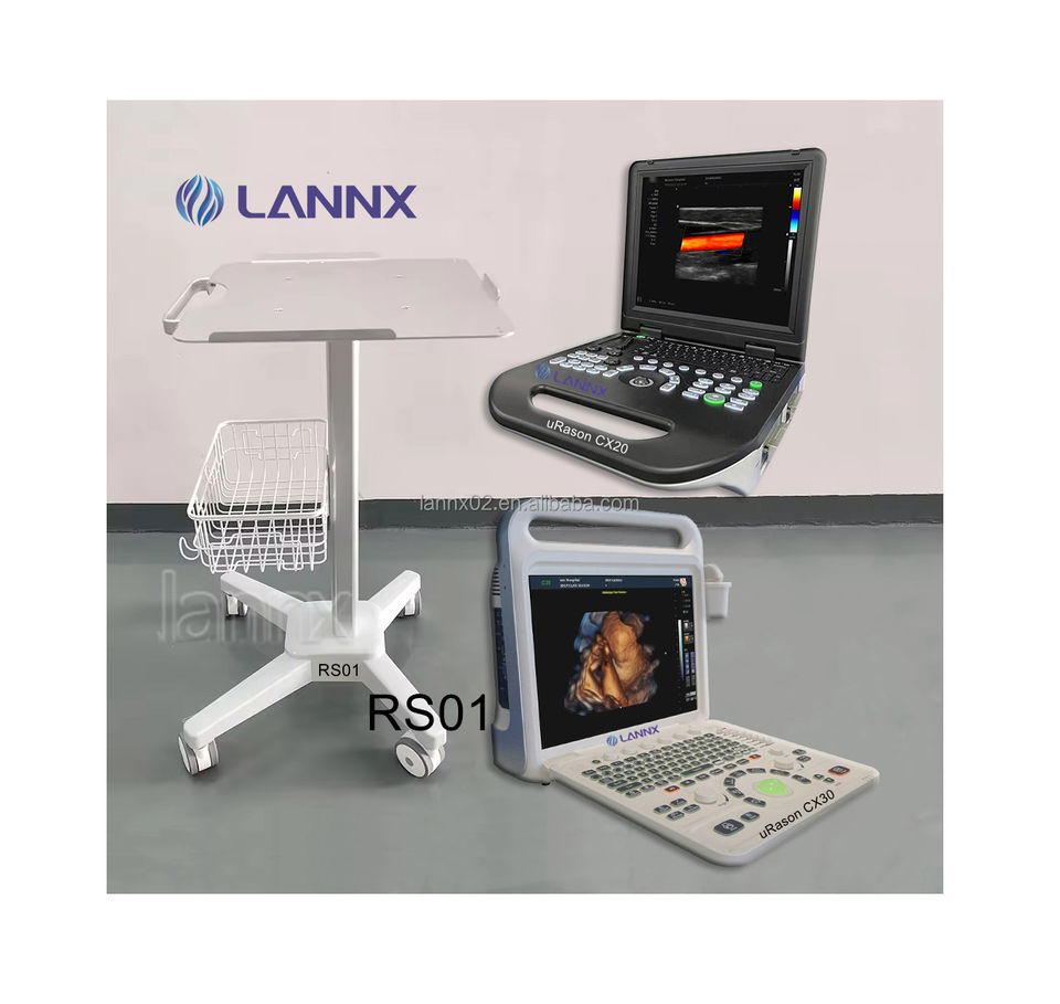 LANNX RS01 Medical Scanner Instruments Ultrasound Trolley Portable ...