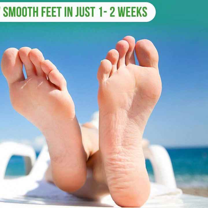 factory Peels Away Calluses and Dead in 2 Weeks Skin Care Peeling ...