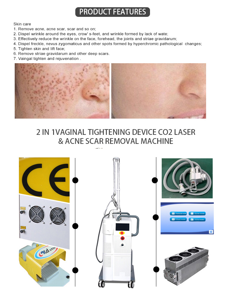 Co2 Laser System Powerful Machine Scar Remove Skin Tighten Stretch ...