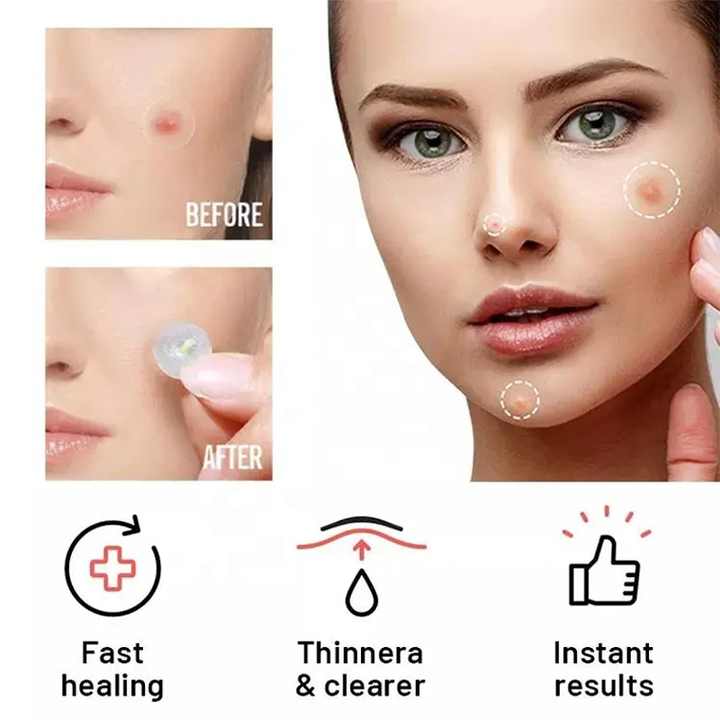 Wholesale Custom Spot Face Dots Treatment Clear Acne Absorbing Cover ...