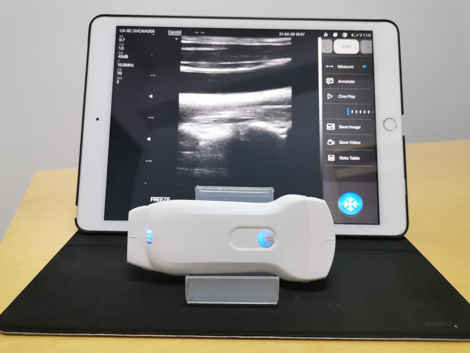 3 in 1 Ultrasound Probe - Versatile and Portable Solution