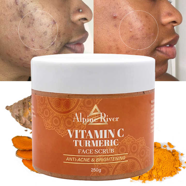 OEM Wholesale Skin Care Facial Scrub Anti-Acne Brightening Skin ...
