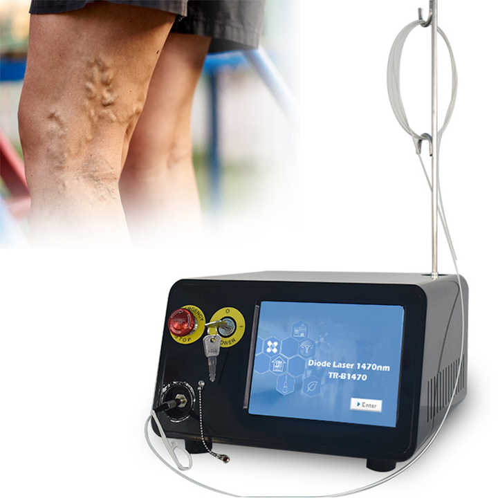 EVLT / EVLA 1470 Diode Laser for Varicose Veins Treatment