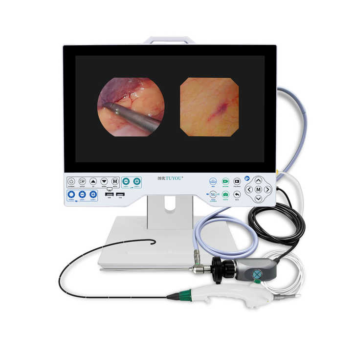 Factory Tuyou All-in-One Portable Medical Endoscopic System Rigid ...