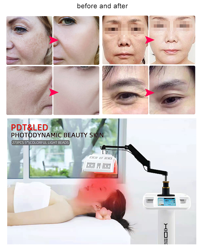 Advanced LED Therapy Device For Acne Wrinkle Removal, Skin Tightening ...