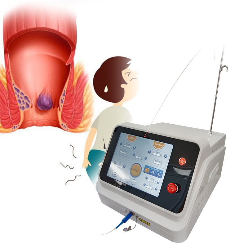 Haemorrhoidectomy 980+1470nm Fiber Laser Cutting Hemorrhoids Soft ...