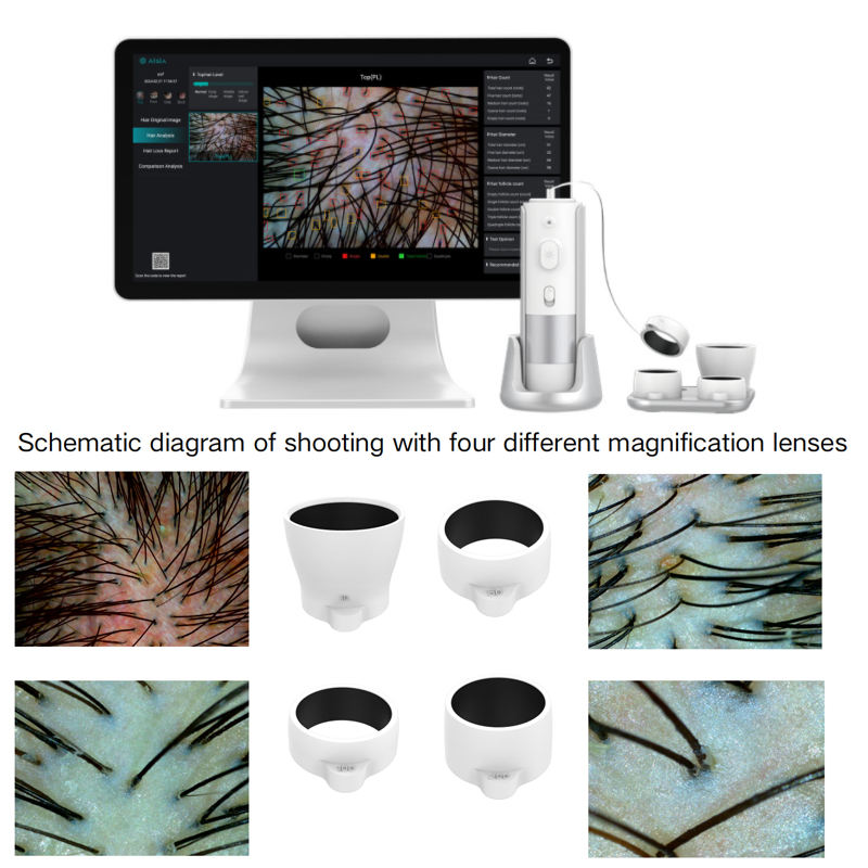CE-Certified AI Hair Scalp Analyzer Connect Testing Hair and Scalp ...
